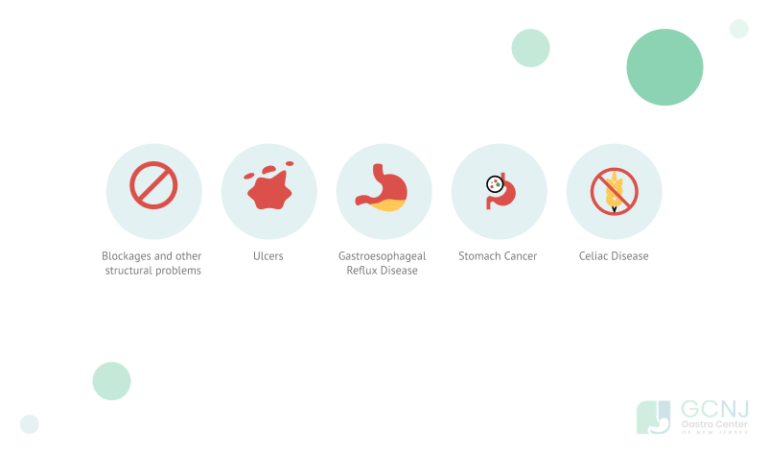 A Complete Overview of Upper GI Endoscopy